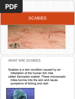 Brightness Acuity Test | PDF | Visual Acuity | Cataract