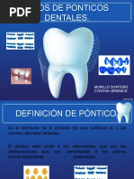 Elaboración de Ganchos Adams en Ortodoncia | PDF | Ortodoncia | Naturaleza