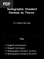 Scanner TDM Thoracique en Coupes | PDF | Aorte | Thorax
