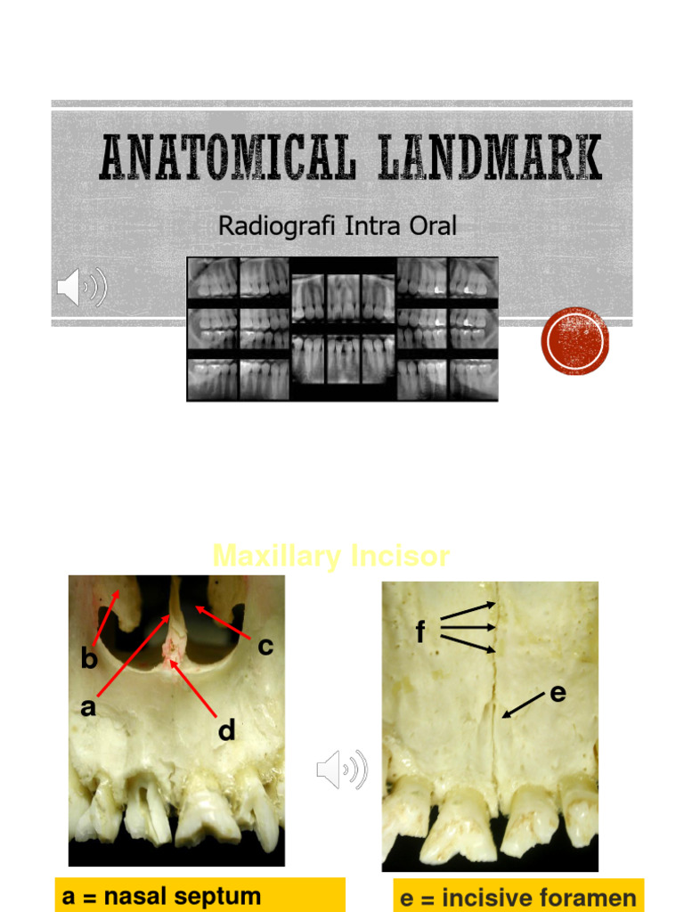 Anatomical Landmark PPT. Tgl 25 | PDF | Human Nose | Human Head And Neck