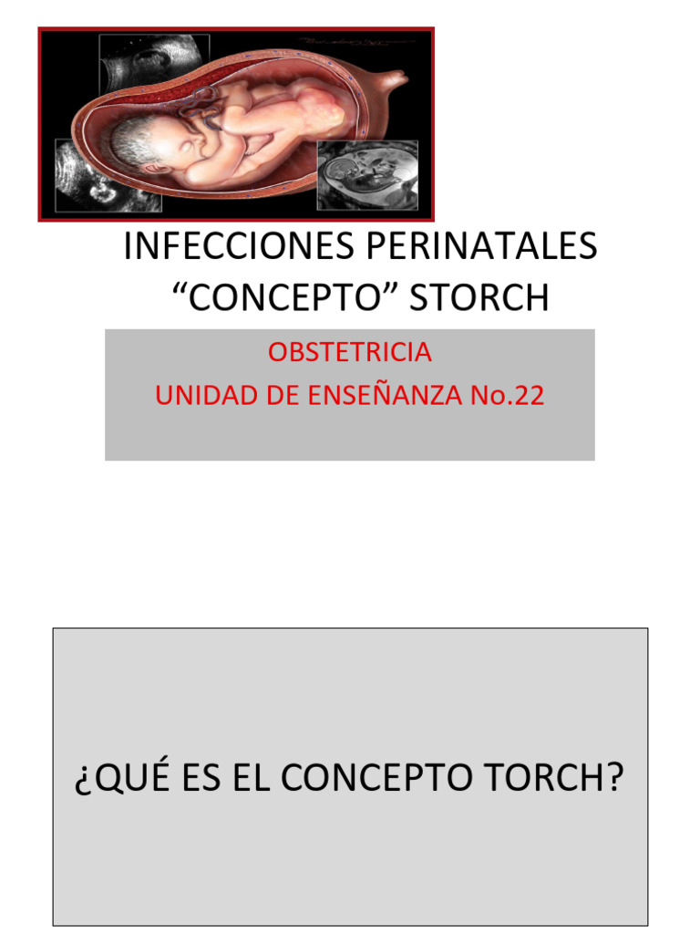 22.COMPLEJO TORCH | PDF | Herpes Simple | Infección