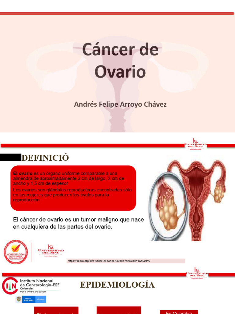 CANCER DE OVARIO (1) | PDF | Cáncer | Ovario