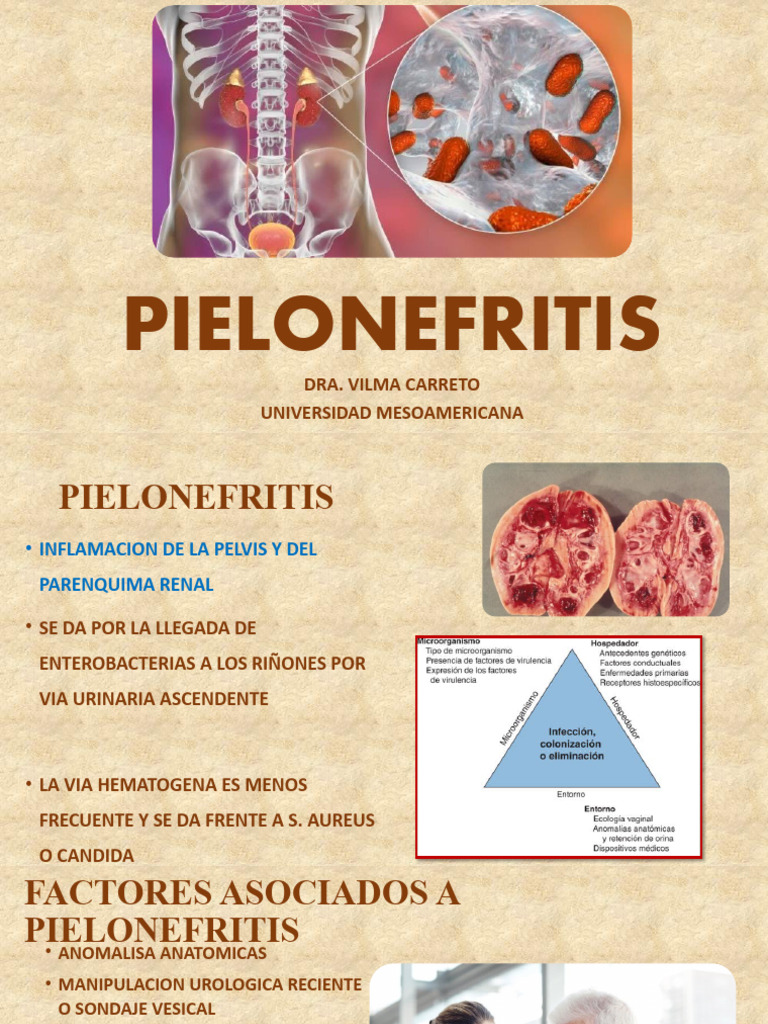 PIELONEFRITIS | PDF | Riñón | Medicina CLINICA