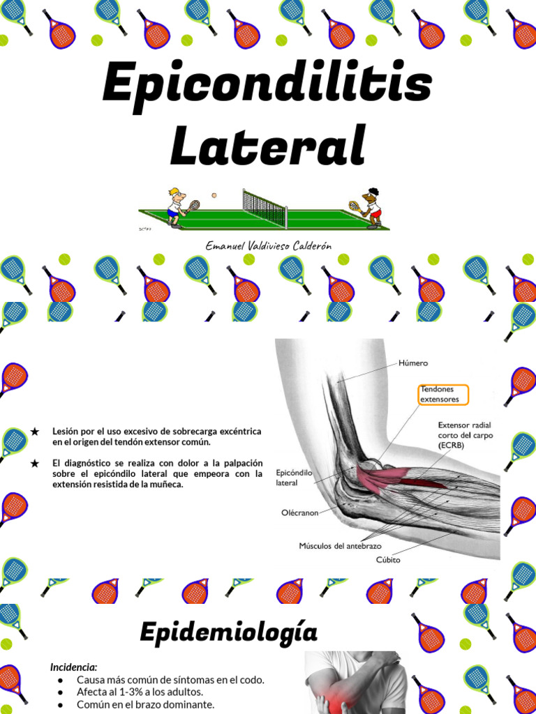 Epicondilitis Lateral y Medial | PDF | Sistema musculoesquelético ...