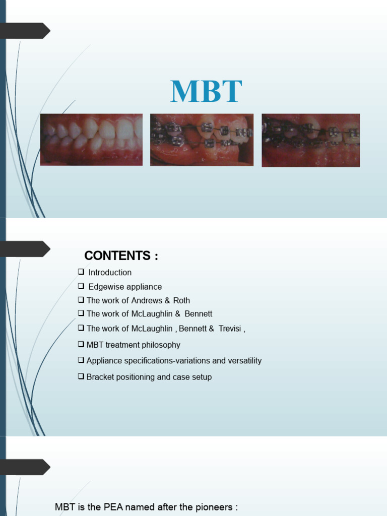 MBT | PDF | Orthodontics | Dental Anatomy