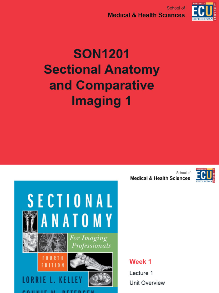 ECU SON1101 Week 01 Lecture 1 | PDF | Medical Imaging | Anatomy