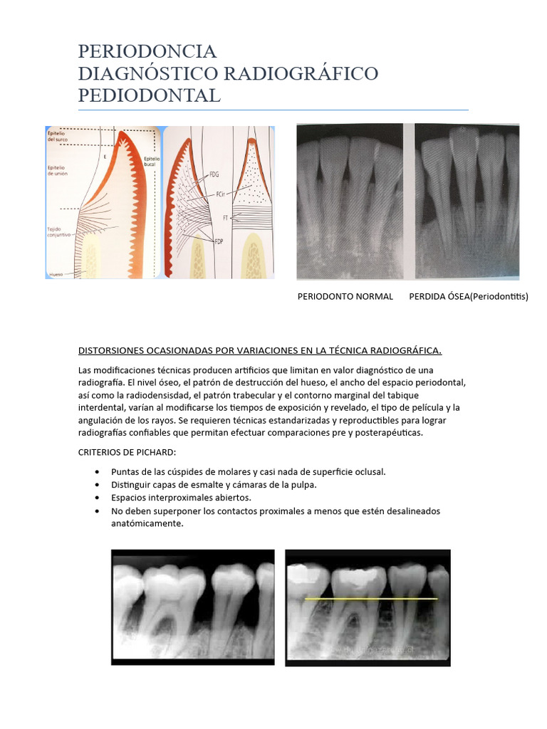 DX Periodontal | Descargar gratis PDF | Lesión | Hueso