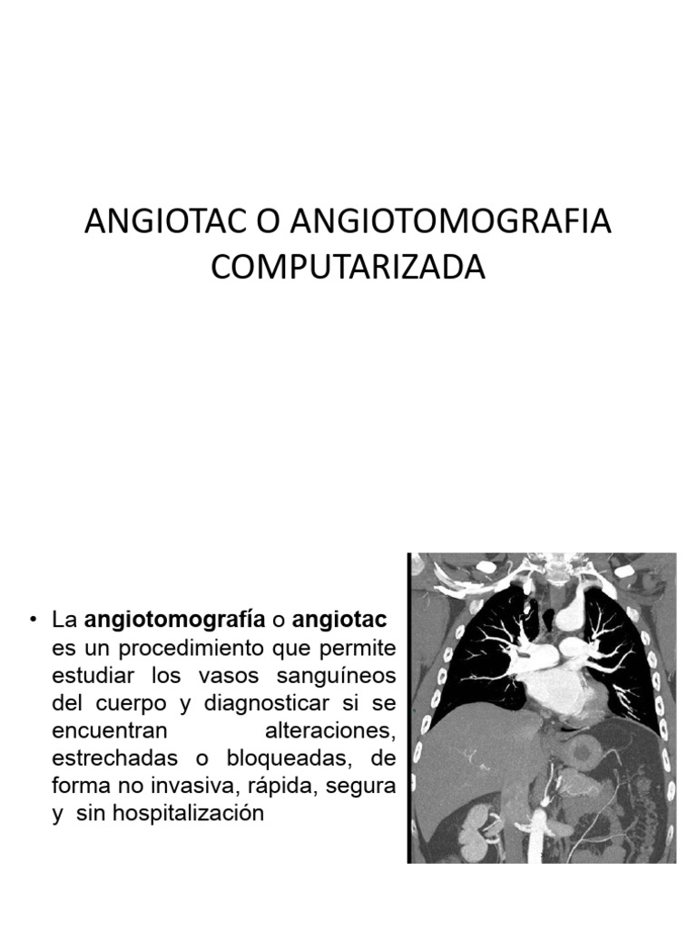 Angiotac o Angiotomografia Computarizada | PDF