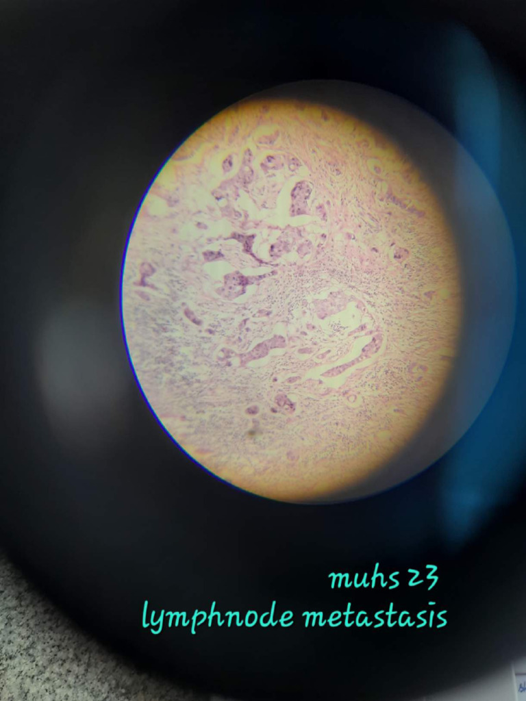 Slides Pathology Muhs | PDF