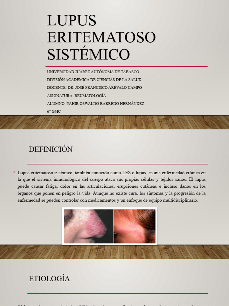 Lupus eritematoso sistémico | PDF | Sistema inmune | Medicina CLINICA