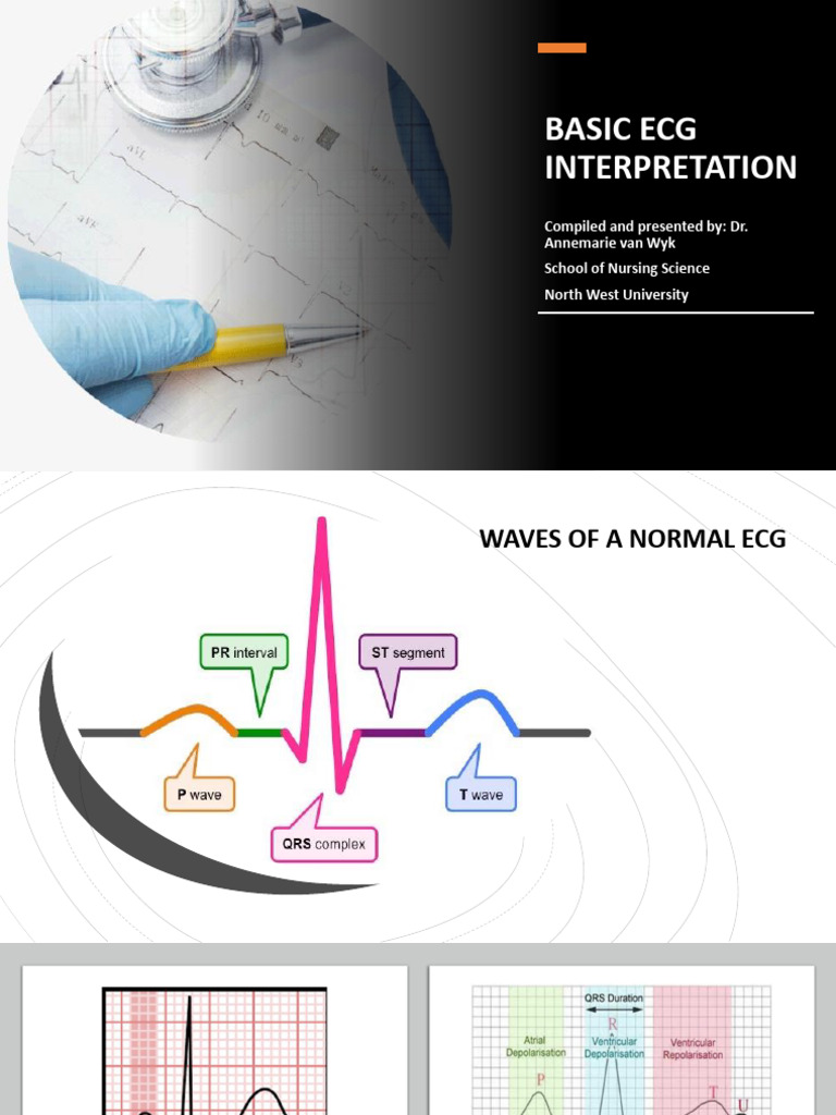 Basic Ecg Interpretation Powerpoint For The Osce | PDF | Electrocardiography | Heart Rate