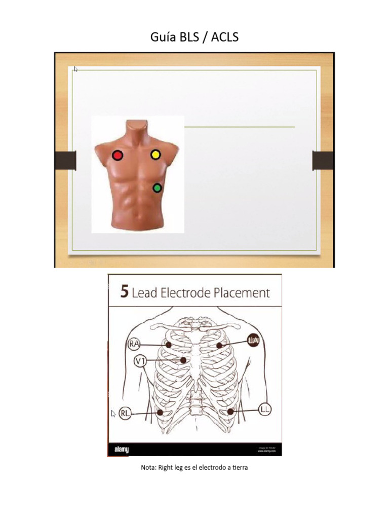 Ritmos BLS ACLS | PDF | Corazón | Sistema cardiovascular