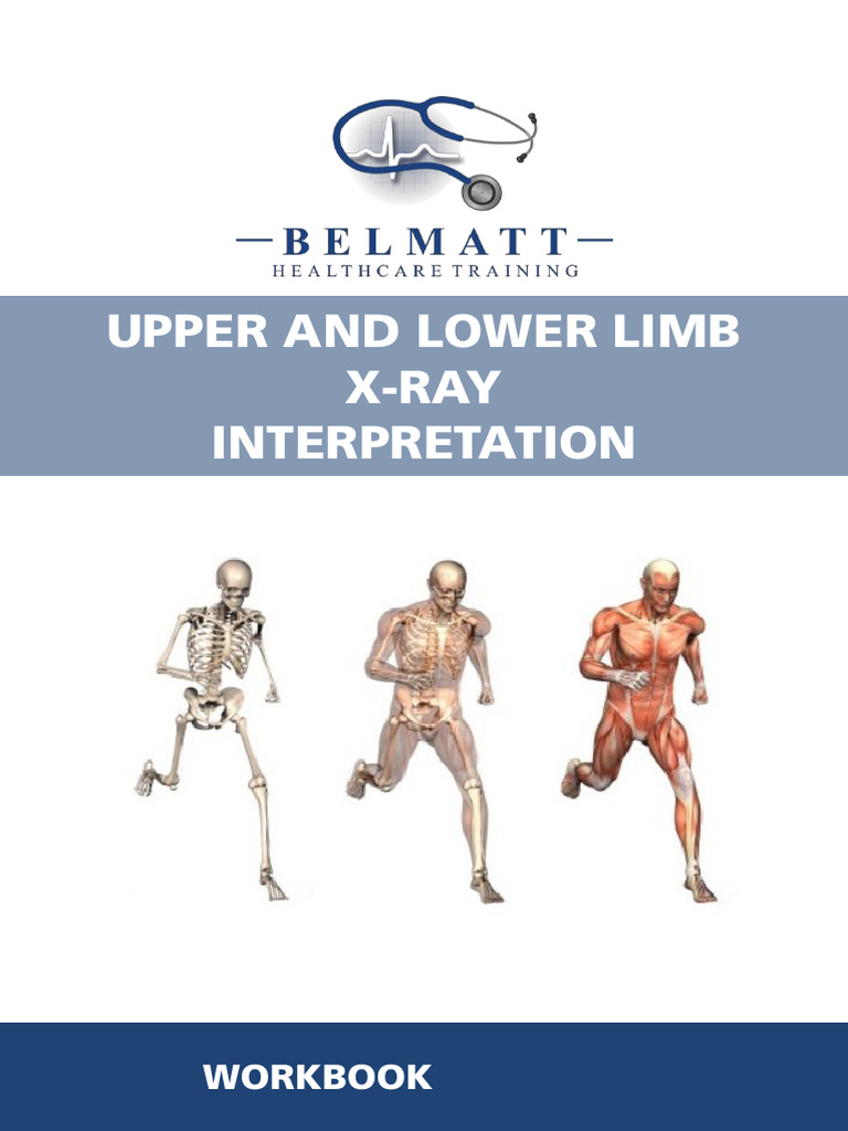 Upper and Lower Limb X Rays Qeytgv | PDF | Anatomical Terms Of Motion ...