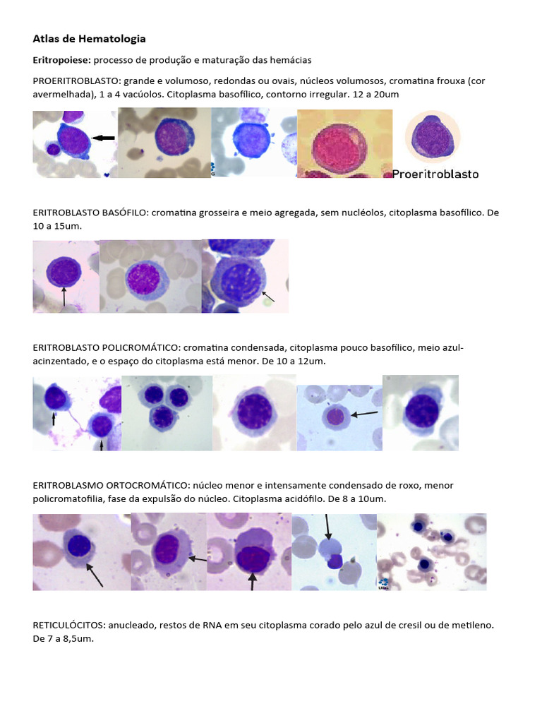 Atlas de Hematologia | PDF