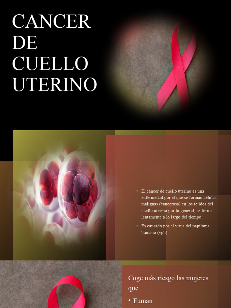 Cancer de Cuello Uterino | PDF