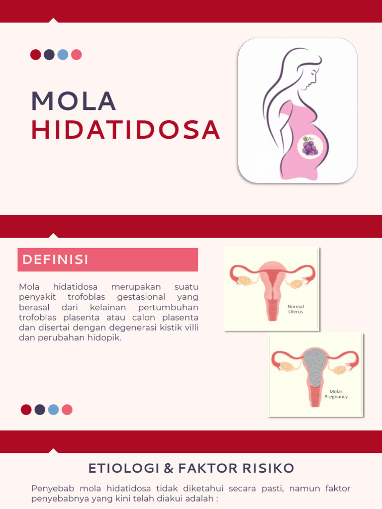 Mola Hidatidosa | PDF