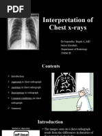 ?1 - Chest X-Ray Interpretation - A Structured Approach - Radiology ...