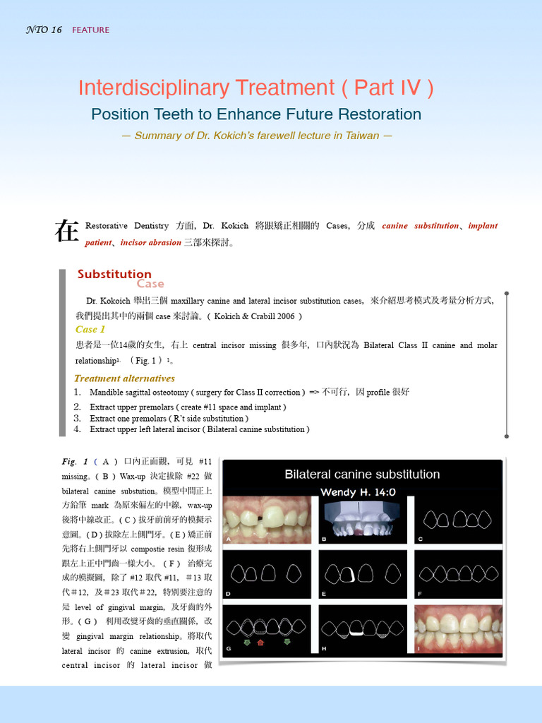 IDT Kokich 4 | PDF