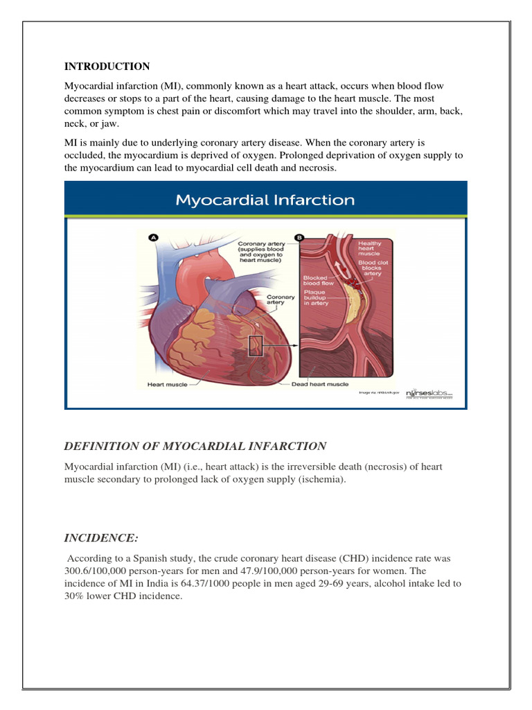 Myocardial Infarction | PDF | Coronary Circulation | Heart