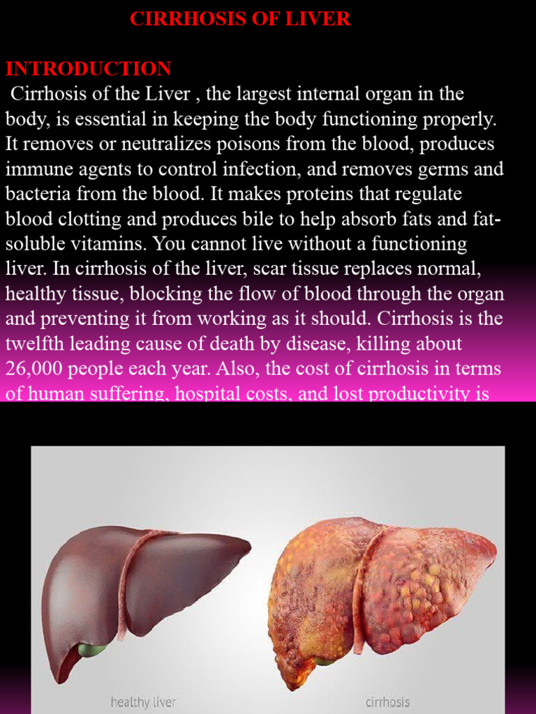 Col | PDF | Cirrhosis | Liver