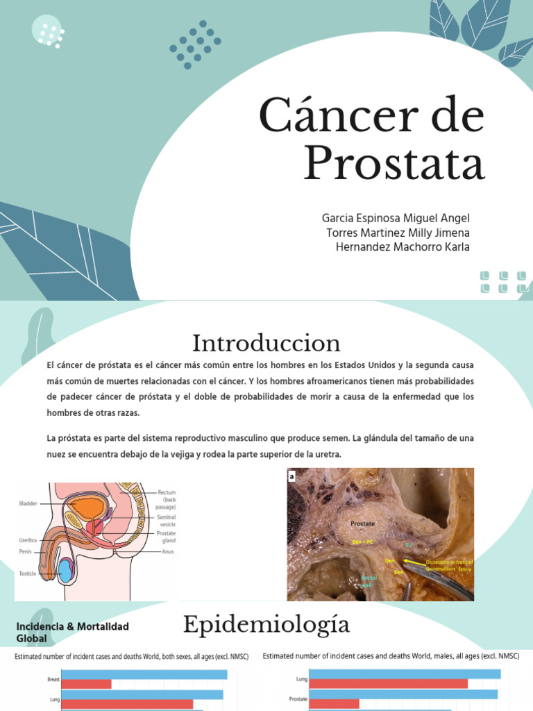 Ca de prostata Equipo | PDF | Cancer de prostata | Cáncer