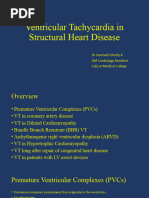 Ventricular Tachycardia - Monomorphic VT - LITFL | PDF ...