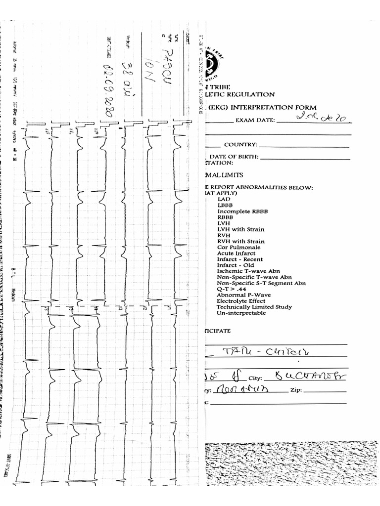 EKG form Bellator | PDF