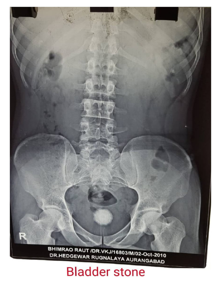 surgery x-rays and barium studies | PDF