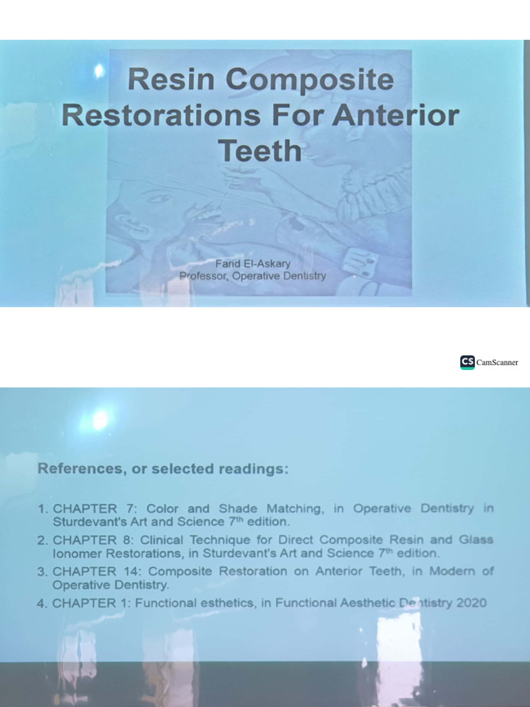 Anterior Composite Pdf