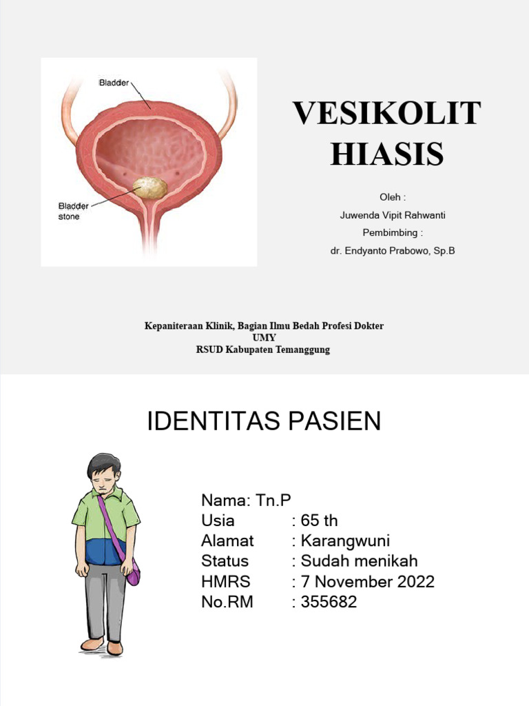 Vesikolithiasis | PDF