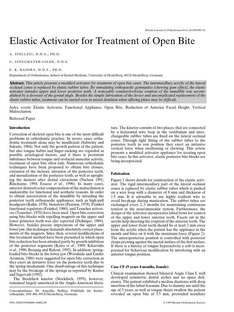 Elastic Activator For Treatment of Open Bite | PDF | Physiognomy ...