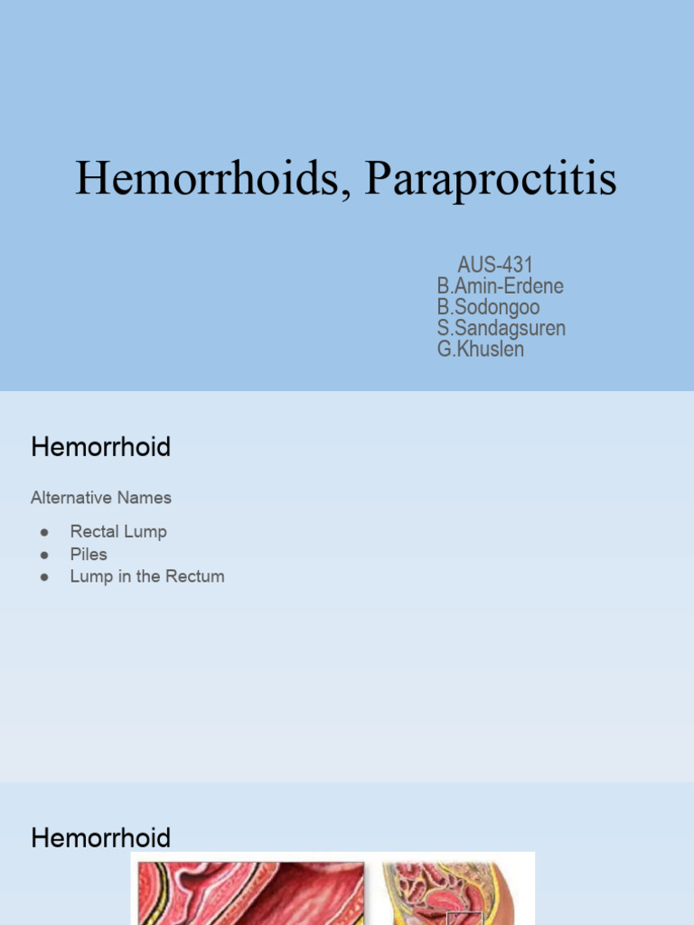 Hemorrhoids, Paraproctitis | PDF | Hemorrhoid | Gastroenterology