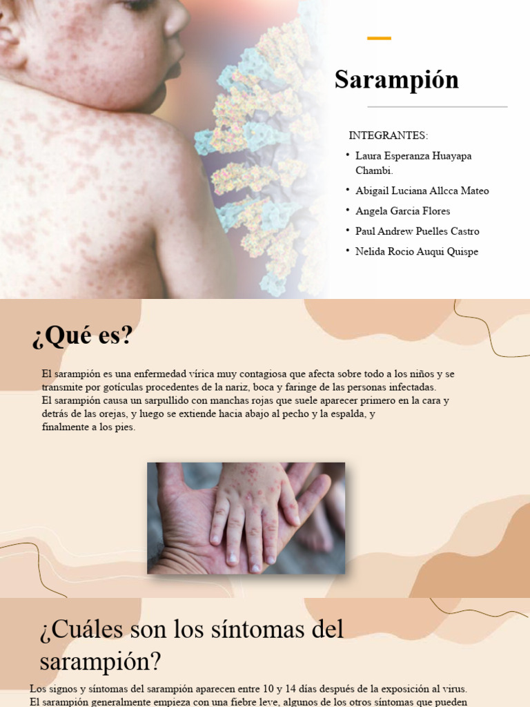 Causas y síntomas del sarampión | PDF | Sarampión | Medicina CLINICA