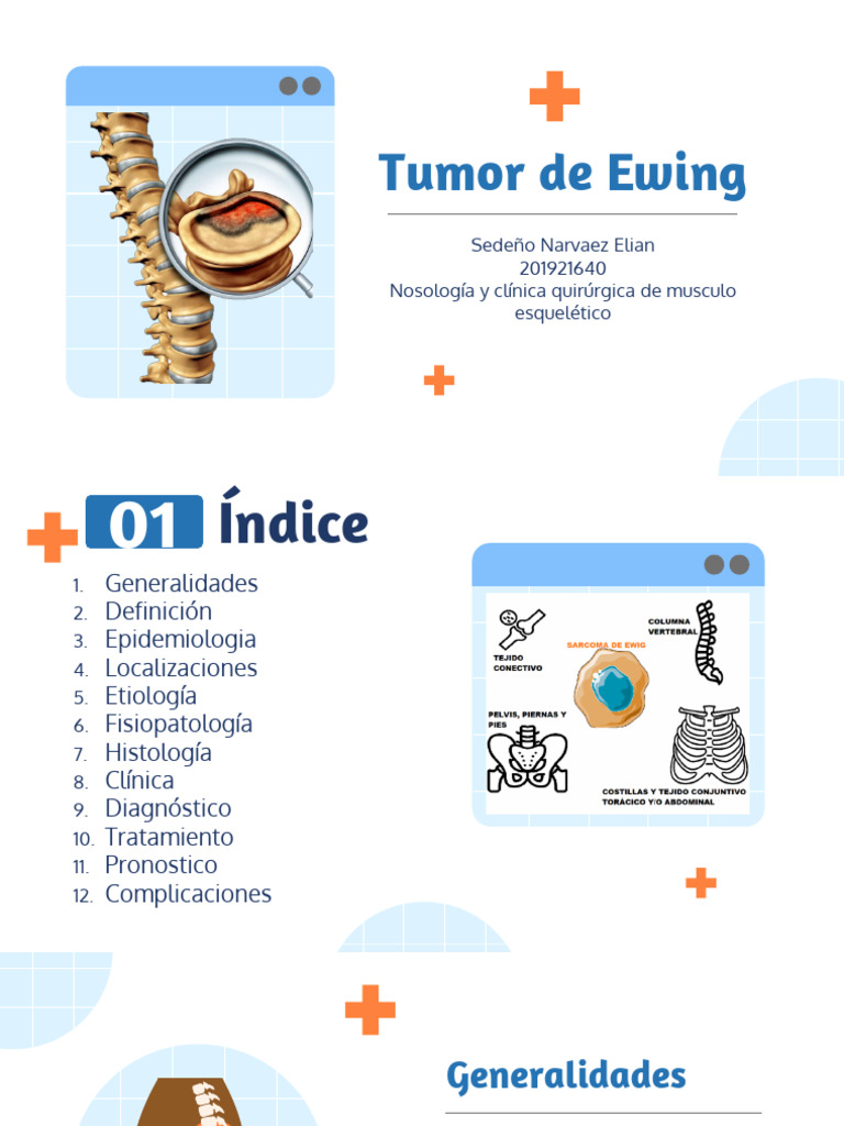 Tumor de Ewing | PDF | Sarcoma | Cáncer