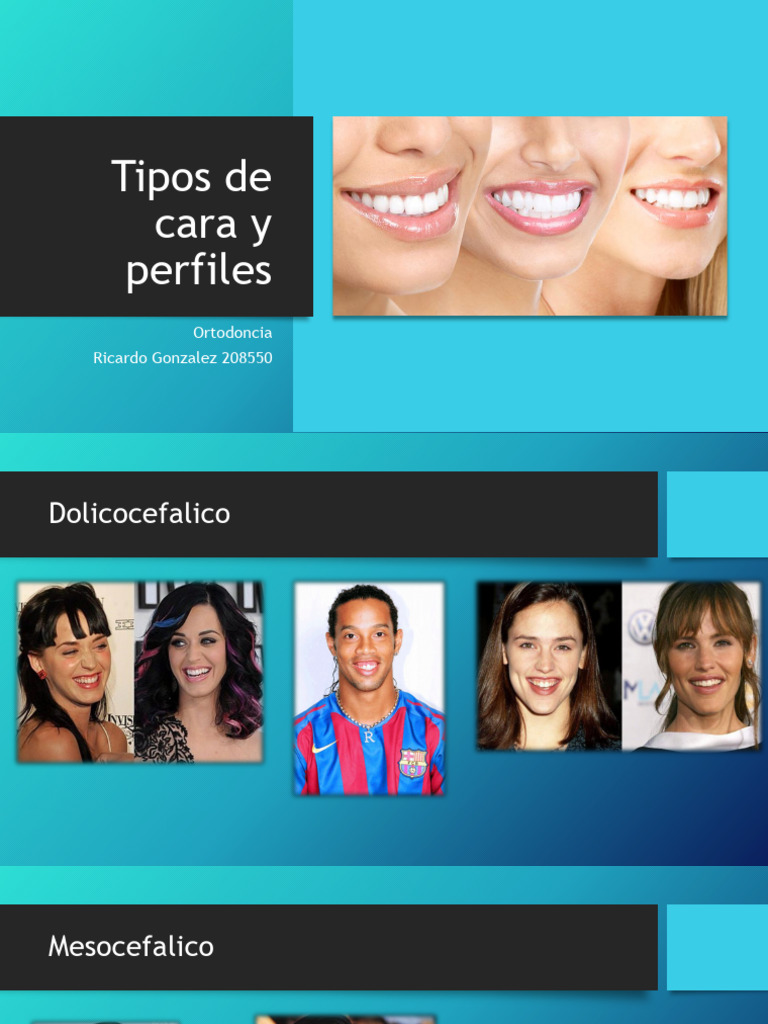 Tipos de Cara y Perfiles | PDF