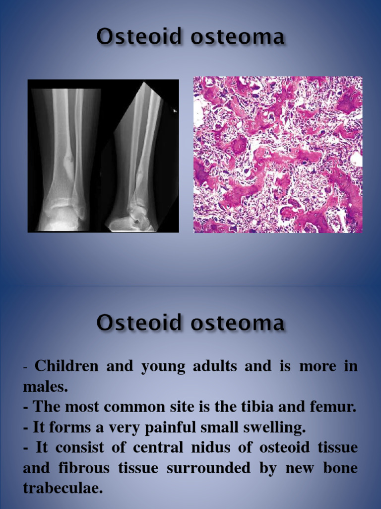 Bone 2 | PDF | Bone | Gout