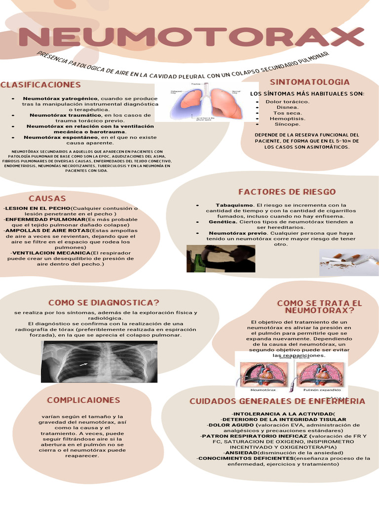 Clasificación y tratamiento del neumotórax | PDF