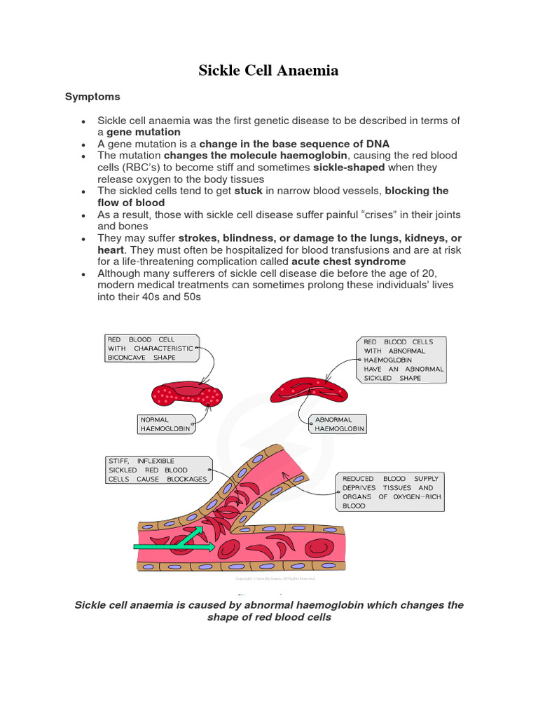 Sickle Cell Anaemia Print | PDF