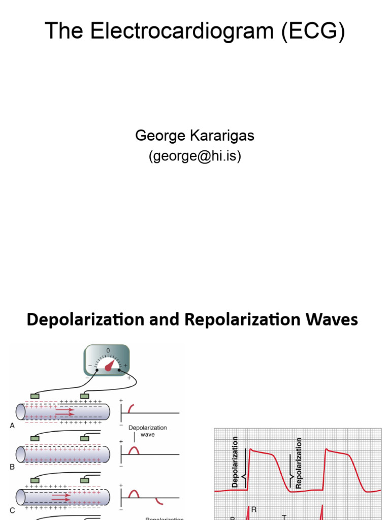ECG Slides | PDF