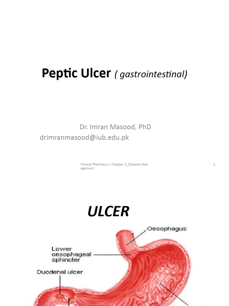 GI Ulcer | PDF
