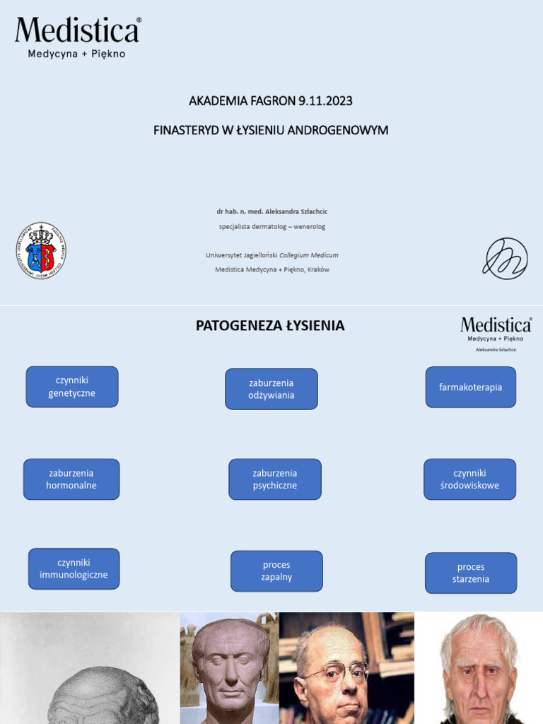 Materiał Finasteryd W Leczeniu Łysienia Androgenowego | PDF