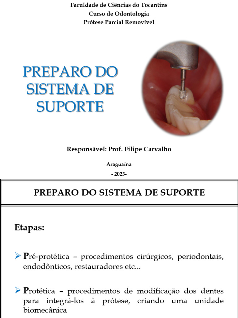 10 - Preparo Do Sistema de Suporte em PPR | PDF | Dente | Esmalte dentário