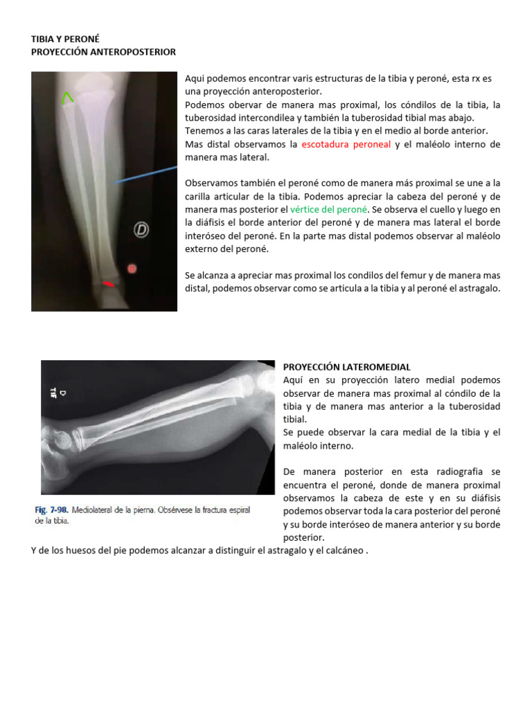 Anatomía Radiográfica de Tibia y Peroné | PDF | Pie | Anatomía humana