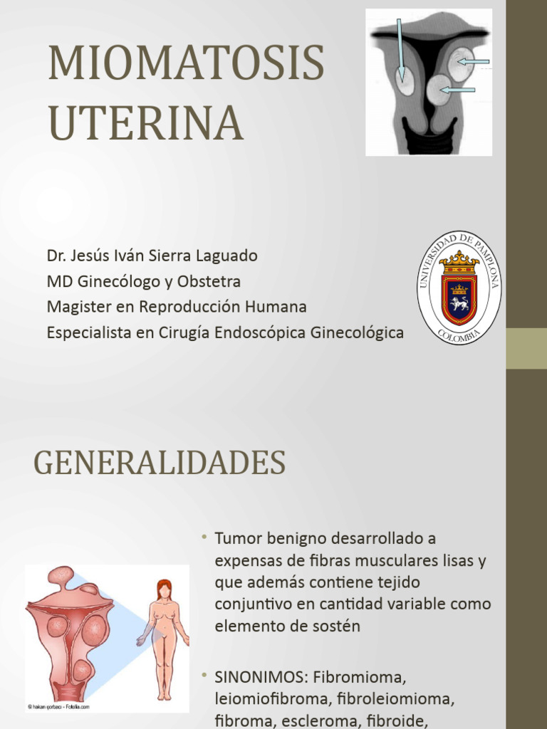 17 - Miomatosis Uterina | PDF | El embarazo | Estradiol