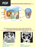Interpretasi Vision-Test Jaeger | PDF | Visual Impairment | Visual Acuity
