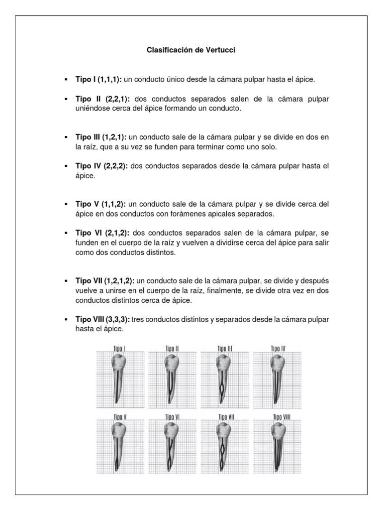 Clasificación de Vertucci | PDF