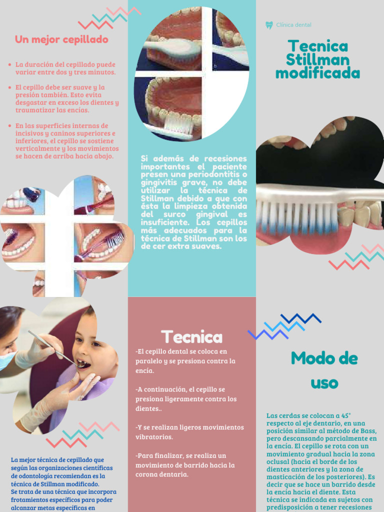 Técnica de cepillado Stillman modificada | PDF | Diente | Odontología