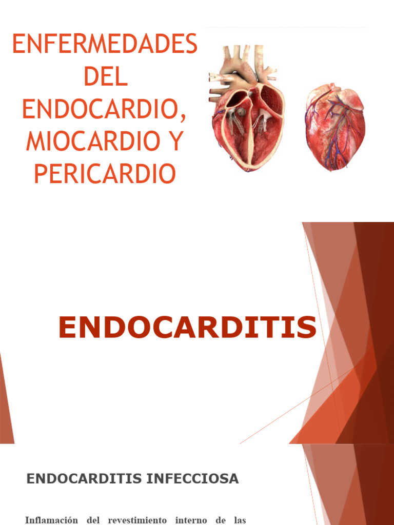 Enfermedad Del Endocardio, Miocardio, y Pericardio | Descargar gratis ...