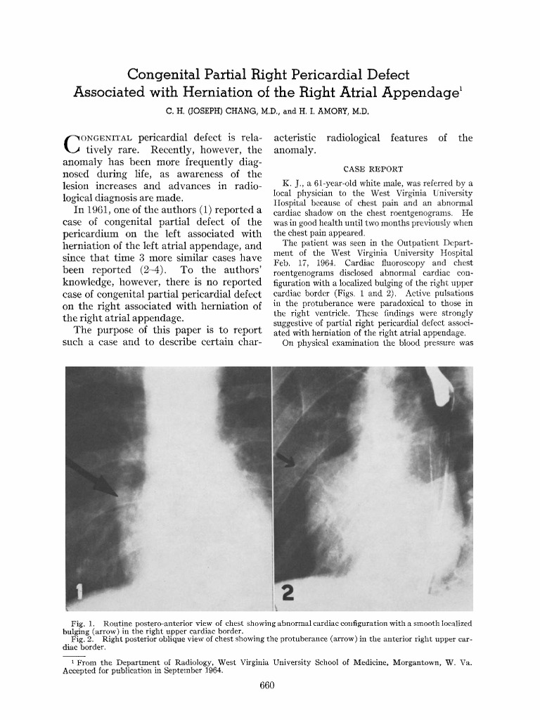 Congenital Partial Right Pericardial Defect Associated With Herniation ...