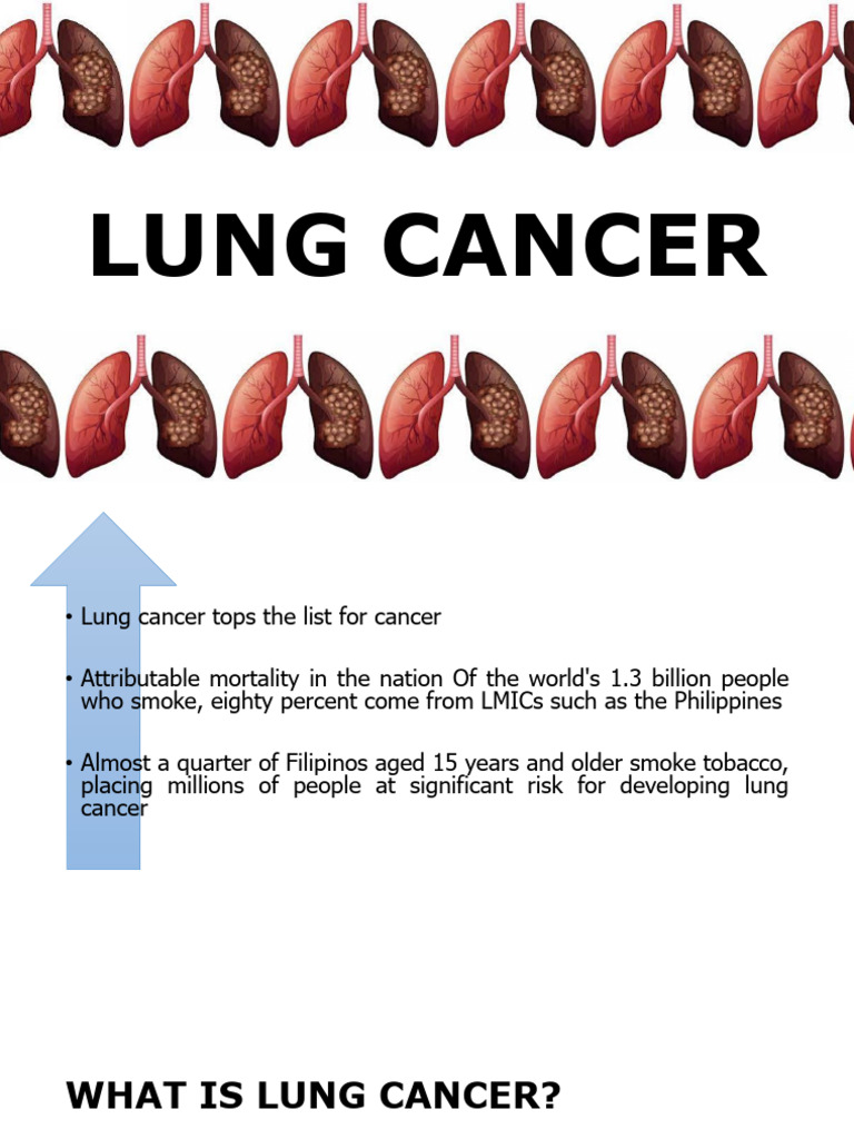 Lung Cancer | PDF | Lung Cancer | Cancer